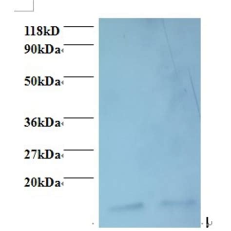 Anti Macrophage Migration Inhibitory Factor Antibody A41017