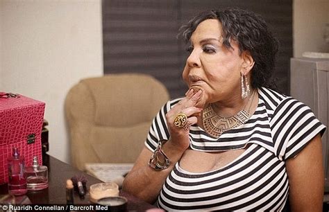 Rajee Narinesingh Victim Of Fake Doctor Gets Relief For Her Cement Face Brand Icon Image