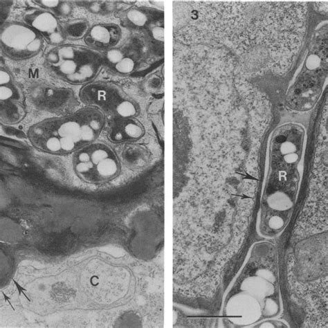 Rhizobia R Present In An Intercellular Space Is Of A Nodule A