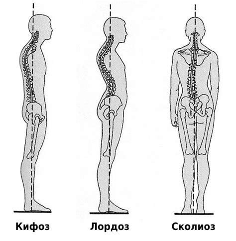 Норма искривления