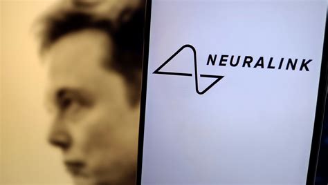 Neuralink Des Milliers De Volontaires Pour La Première Puce Du Cerveau