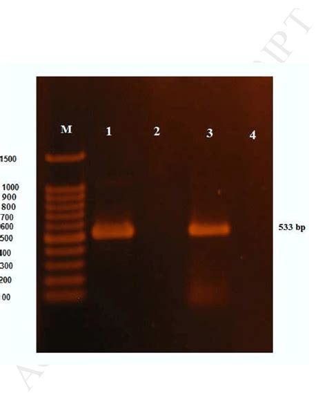 Electrophoresis Of Pcr Products Amplified From Kpc Gene In 1 Agarose Download Scientific
