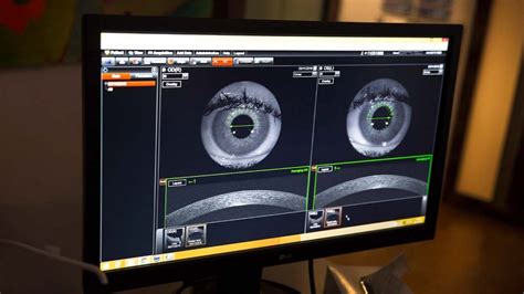 Optical Coherence Tomography How It Works And What It Is For