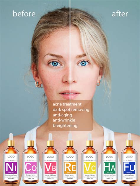 Oem Custom Glutathione Skin Whitening Facial Serum Vitamin C For Dark