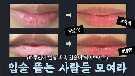 입술 뜯는 버릇 고치기👄 우리 입술 그만뜯어요 🥲🥲 입술 관리법 하루만 투자해요 피부뜯기장애 Youtube