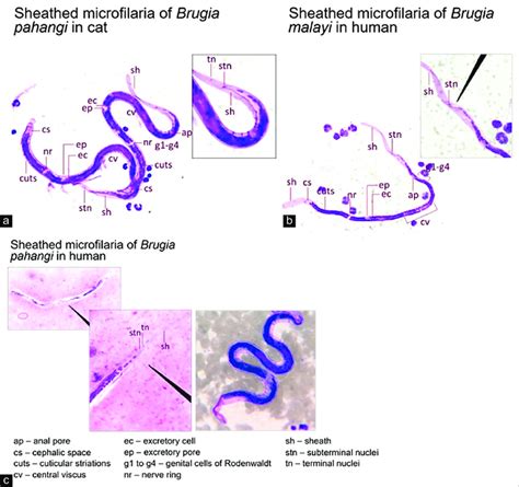 Comparison Of Well Defined Morphologic Characteristics 400×