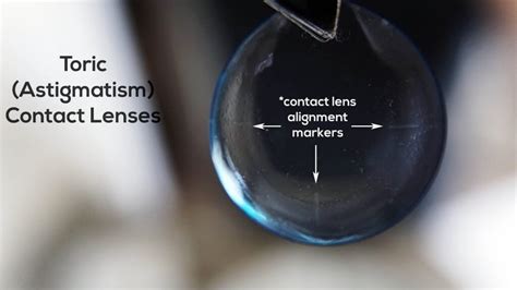 Toric Contact Lenses For Astigmatism