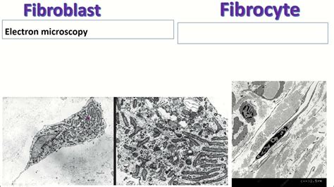 Fibroblast Vs Fibrocyte Key Differences Explained Youtube