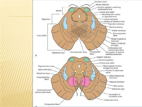 Inferior Colliculus Cross Section