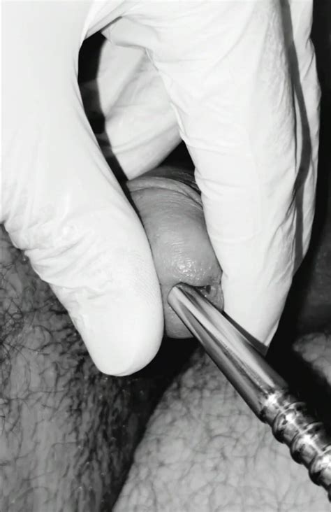 Cbt Solo Urethral Sounding Stretching Thisvid Com