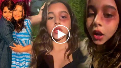 وشها باظ هنا بنت شيرين عبد الوهاب تثير قلق الجمهور بفيديو وشكلها