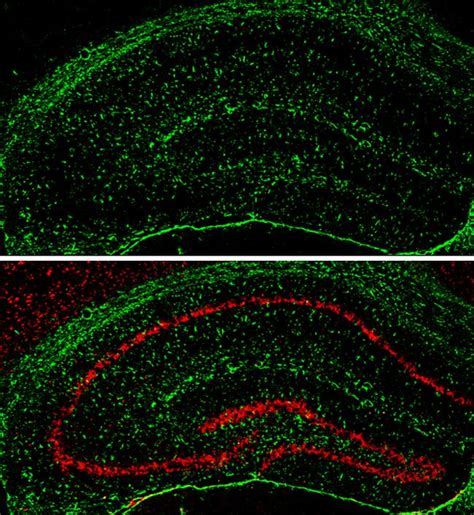 Gfap Antibody Pa5 85261