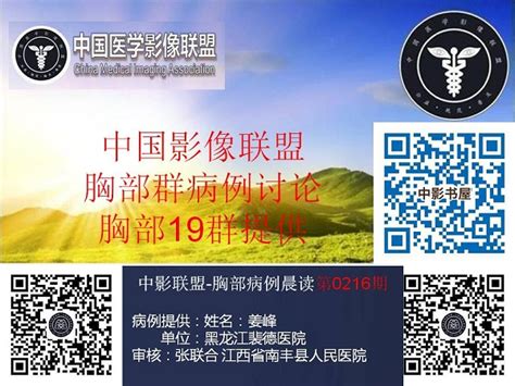 中国医学影像联盟心胸群病例讨论第0216期 中国医学影像联盟 China Medical Imaging Association