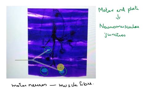 Solved Please Help Thank You Identify The Structure Muscular System Head And Neck Lab