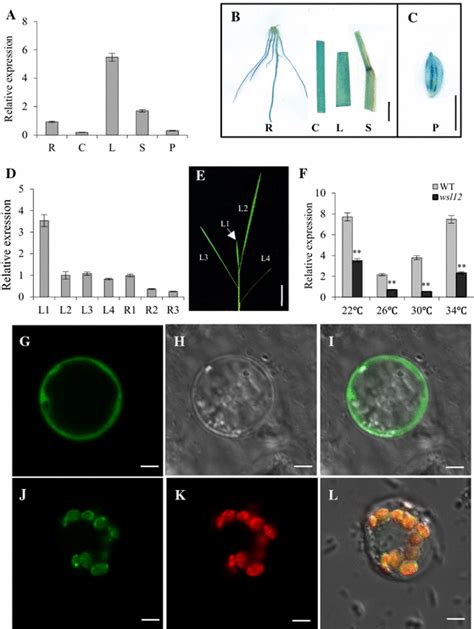 expression pattern analysis and subcellular localization of wsl12 a