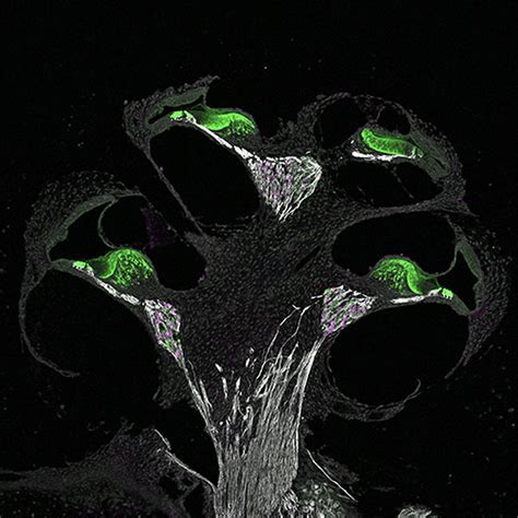 Sciart Spiral Ganglion Neurons In Mouse Nidcd