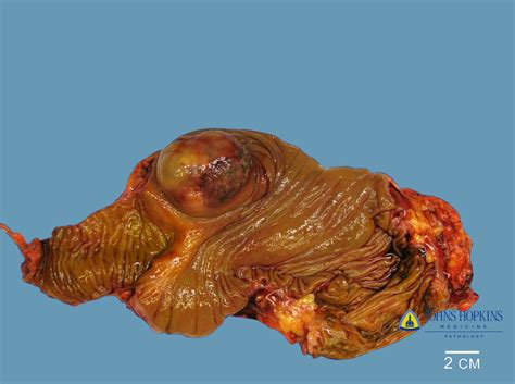 Hamn Surgical Pathology Photo Website