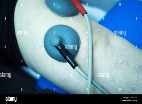 Physiotherapy And Orthopedics Clinic Patient In Electrical Impulse