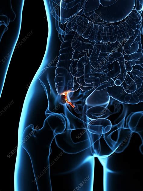 How Big Is An Inflamed Appendix At Kristie Pineda Blog