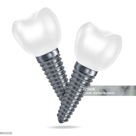 흰색 배경에 고립 된 흰색 치과 임플란트 의치 근접 촬영의 벡터 3d 현실적인 렌더링 치과 의학 및 건강 관리 개념 보철물 디자인 템플릿 전경 임플란트에 대한 스톡 벡터
