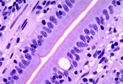Non Ciliated Simple Columnar Epithelium Tissue Types Basement Membrane Exocrine Gland