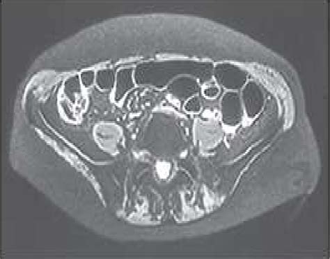 Mri 3 Diagram Quizlet