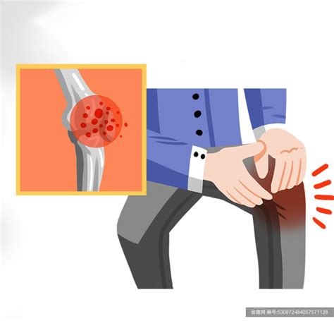 手绘扁平膝关节炎关节炎医疗元素插画psd下载 编号530972484057571128 设图网