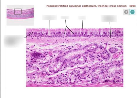Pseudostratified Columnar Diagram