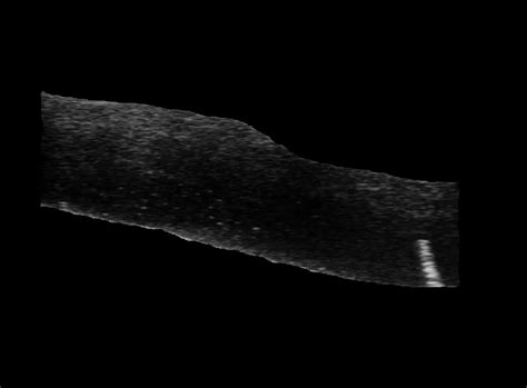 Microbot Project Object Detection Dataset By Microbot Project Yolov8