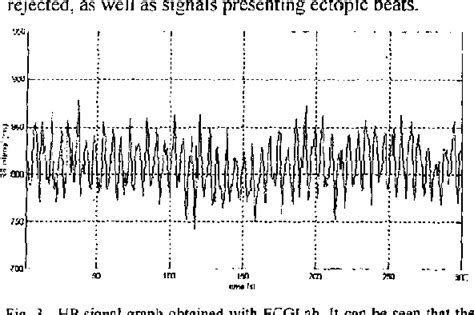 Figure 3 From Development Of A Matlab Software For Analysis Of Heart Rate Variability Semantic