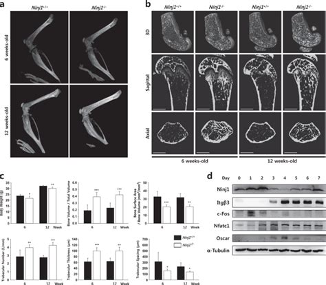 Ninjurin1 通过提高灌注前破骨细胞的存活率来积极调节破骨细胞的发育。experimental And Molecular