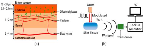 Progress And Perspectives Of Mid Infrared Photoacoustic Spectroscopy For Non Invasive Glucose