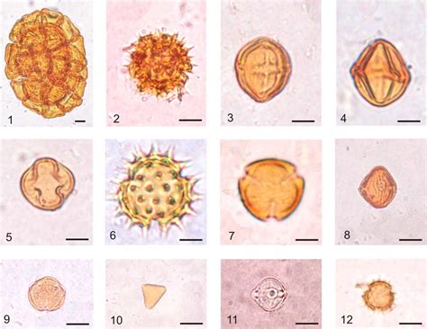 Pollen Under Microscope 40x At Deloris Colvin Blog