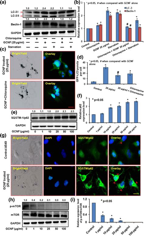 A Western Blot Analysis Of Lc3 Beclin 1 And B Respective