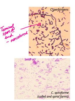 Clostridium Flashcards Quizlet