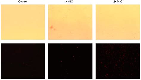 Discovery And Characterization Of A Novel Bacteriocin That Strongly Inhibits Staphylococcus Aureus