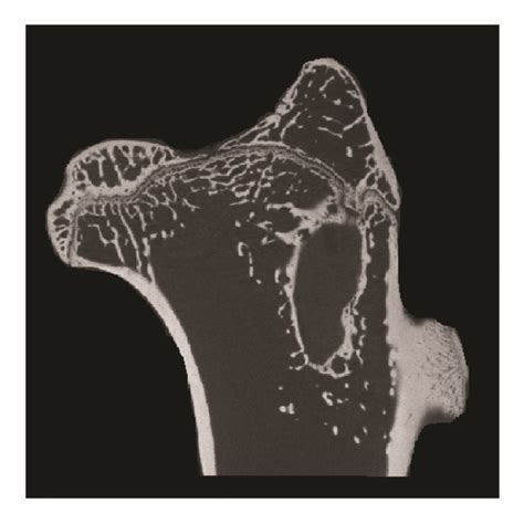 Representative Micro Ct Images From Each Group The Trabecular Bone In Download Scientific