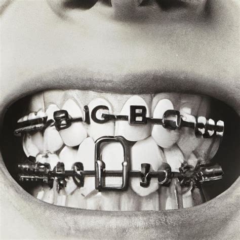 Who Invented Braces Exploring The Pioneers Of Orthodontics The