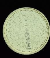 Bacteria Colonies Detection Object Detection Dataset By Bacteria Colonies Detection