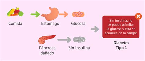 Diabetes Tipo 1 Diagnstico Y Tratamiento Mayo Clinic