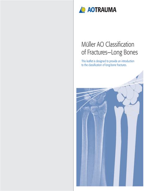 Müller Ao Fracture Classification Long Bones Guide