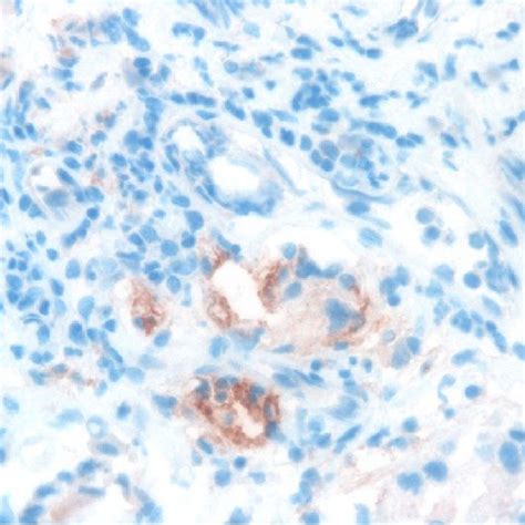 Focal Strong Staining Was Observed In Download Scientific Diagram