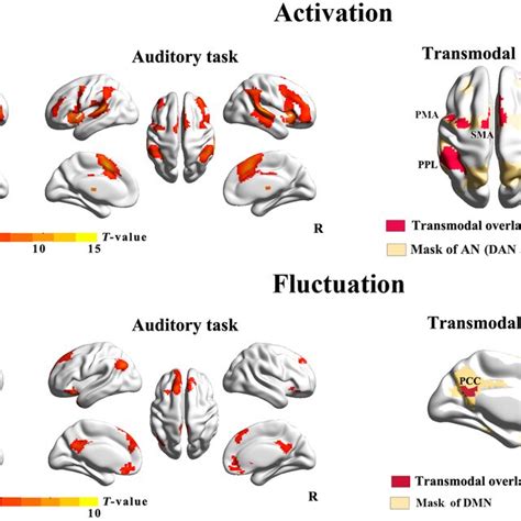 Activation And Fluctuation Of Fmri Activity During Visual And Auditory Download Scientific