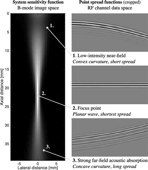 Figure From Ultrasound Imaging From Sparse RF Samples Using System Point Spread Functions