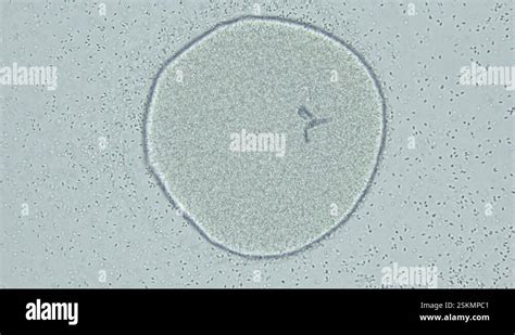 Sperm And Ovule Sea Urchin Strongylocentrotus Pallidus Under Microscope