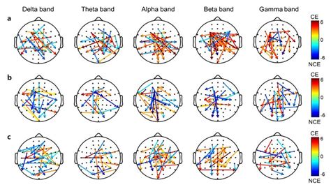Tms Induced Causal Connectivity Differences Between Ce And Nce In A Download Scientific