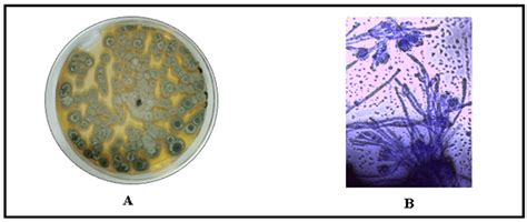 Figure 6 Microscopic Cultural And Morphological Characteristics Of