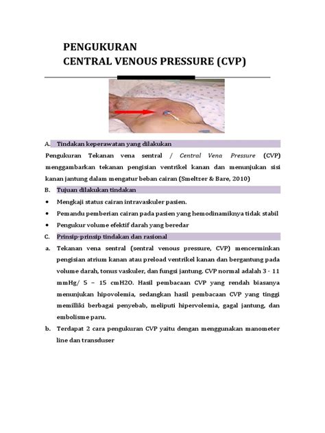 Pengukuran Central Venous Pressure Cvp Pdf