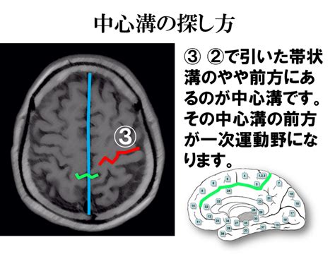 脳画像から一次体性感覚野3 1 2野を探す方法とは リハアイデア