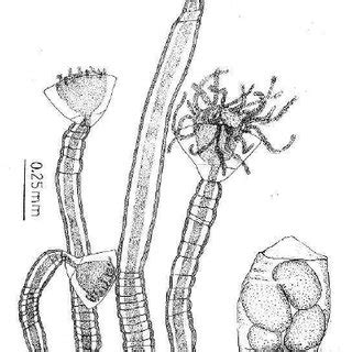 Hydractinia Epidocleensis Colony Showing Gastrozooids And Gonozooids